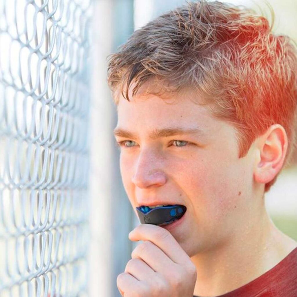 ¿Cómo escoger un protector bucal y cuándo debes usarlo? • Clínica ...